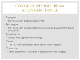Chapter 20: Exposure and Technique Errors | PPT