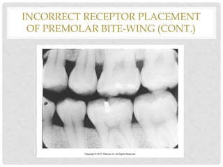 Chapter 20: Exposure and Technique Errors | PPT
