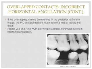 Chapter 20: Exposure and Technique Errors | PPT