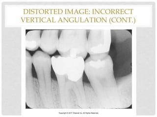 Chapter 20: Exposure and Technique Errors | PPT