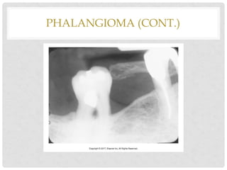 Chapter 20: Exposure and Technique Errors | PPT