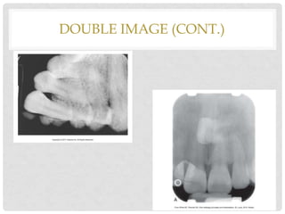 Chapter 20: Exposure and Technique Errors | PPT