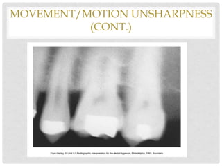 Chapter 20: Exposure and Technique Errors | PPT