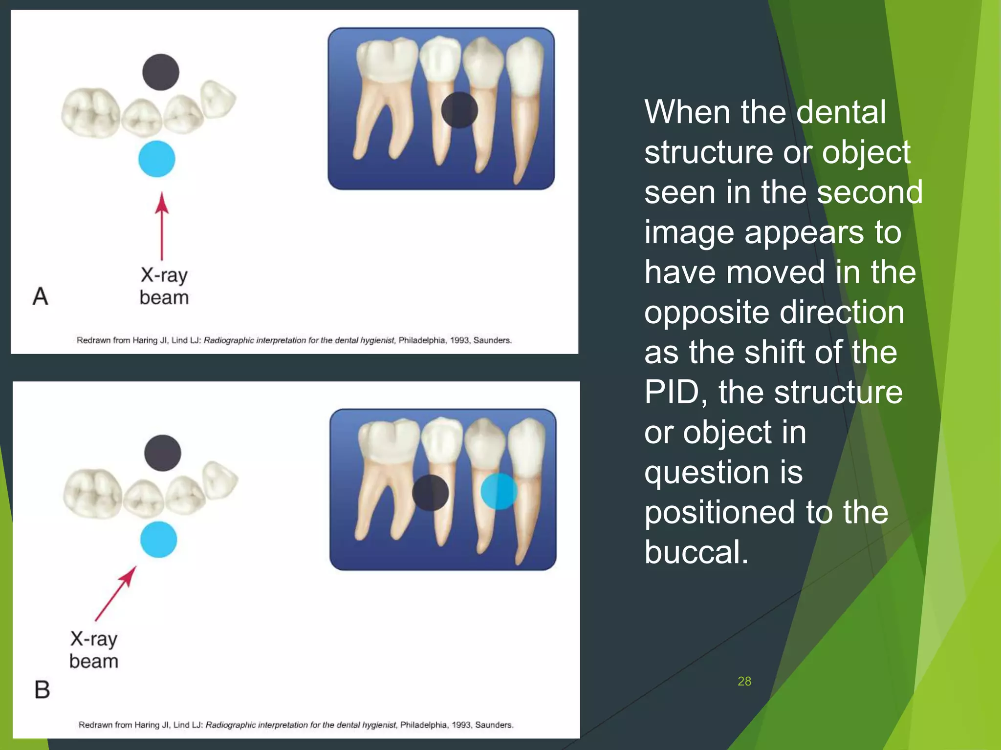 Chapter 21: Occlusal and Localization Technique | PPT
