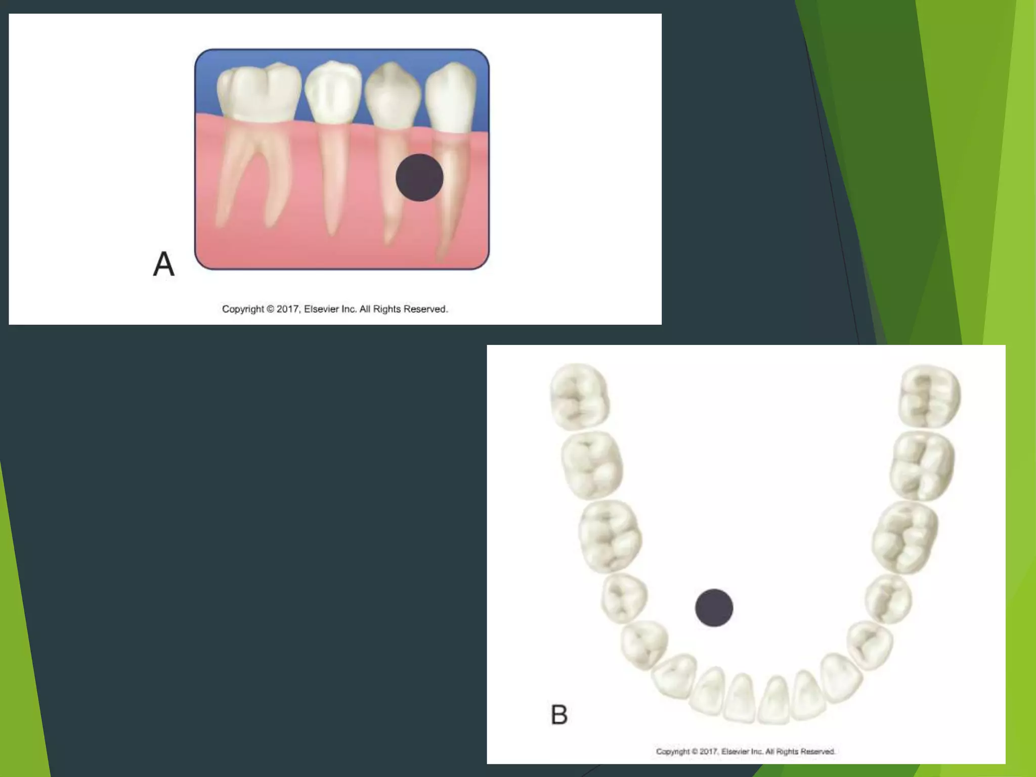 Chapter 21: Occlusal and Localization Technique | PPT