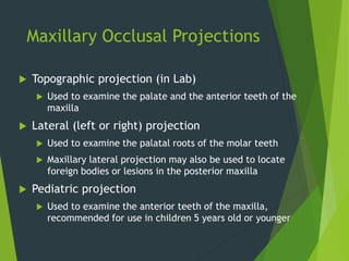 Chapter 21: Occlusal and Localization Technique | PPT