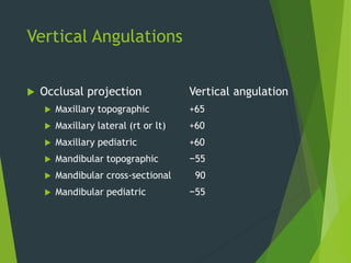 Chapter 21: Occlusal and Localization Technique | PPT
