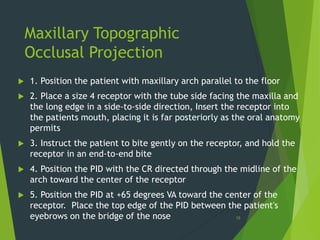 Chapter 21: Occlusal and Localization Technique | PPT