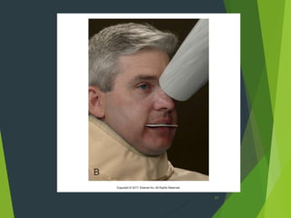Chapter 21: Occlusal and Localization Technique | PPT