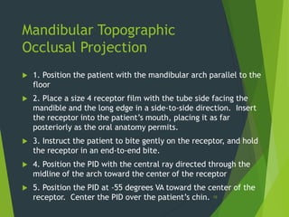 Chapter 21: Occlusal and Localization Technique | PPT