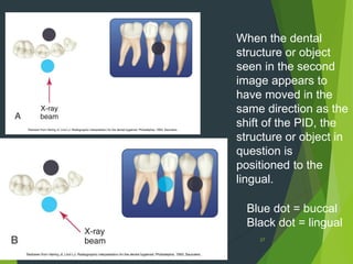 Chapter 21: Occlusal and Localization Technique | PPT
