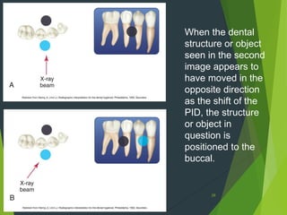 Chapter 21: Occlusal and Localization Technique | PPT