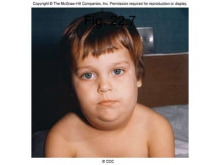 gastrointestinal tract disease - ncm 116 | PPT