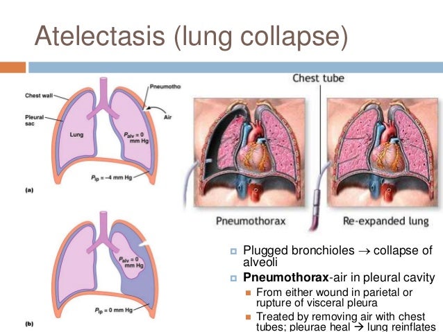 Chapter 22: Respiratory System (#2)