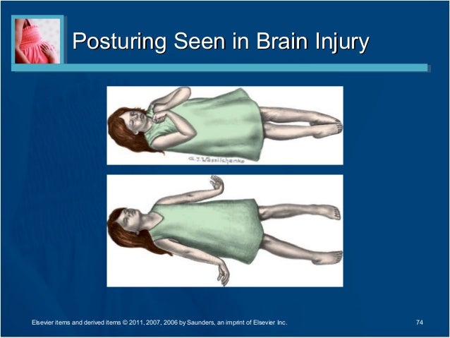 Chapter 23 Power Point