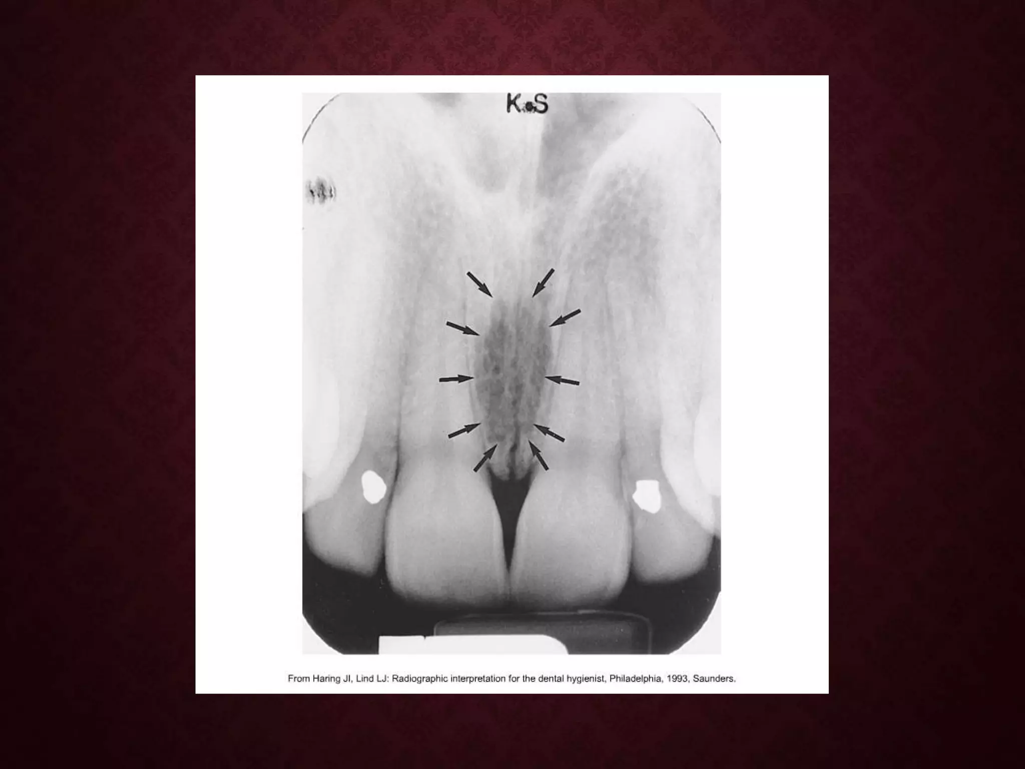 Chapter 27:Normal Anatomy: Intraoral Images | PPTX