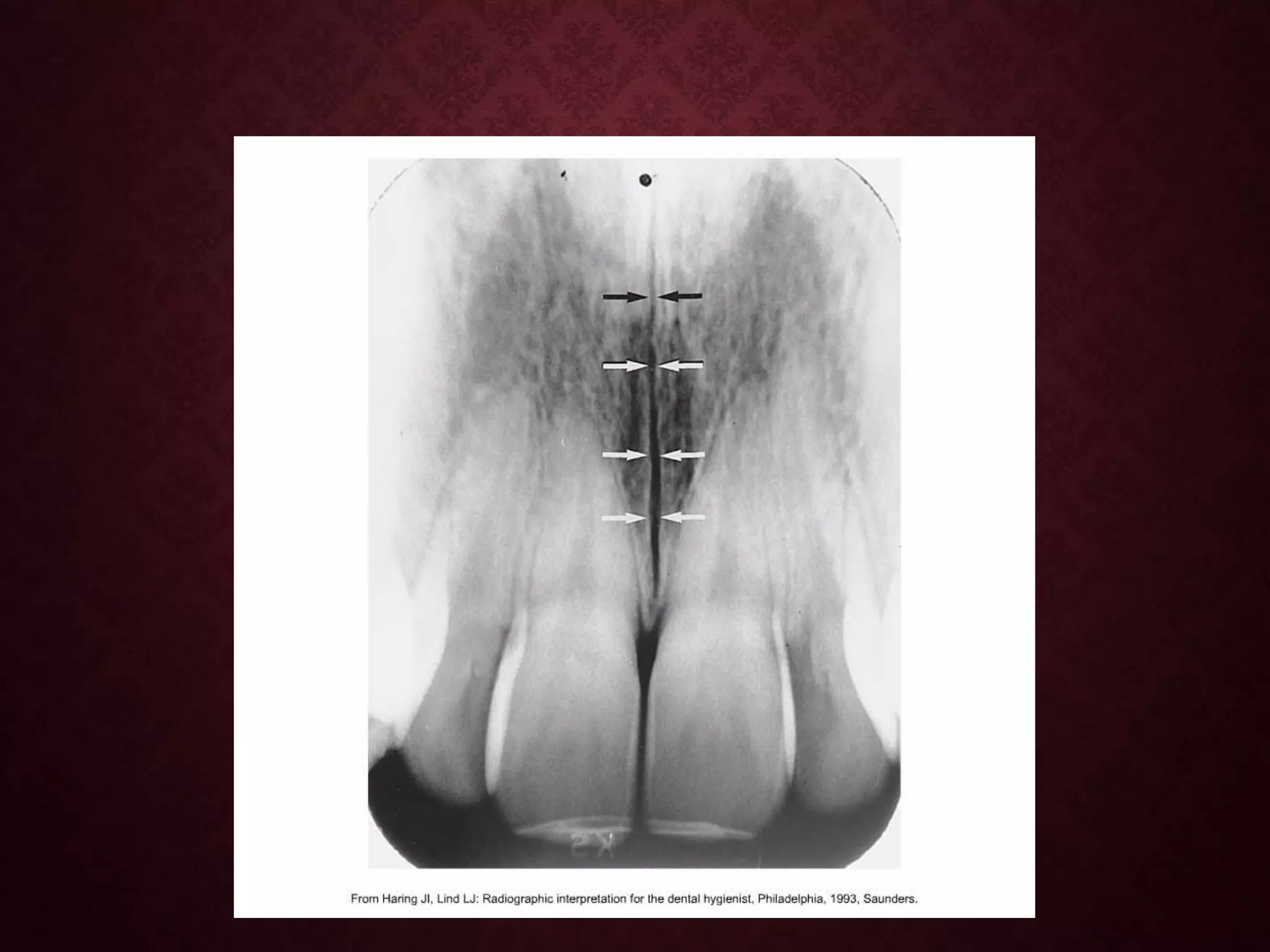 Chapter 27:Normal Anatomy: Intraoral Images | PPTX