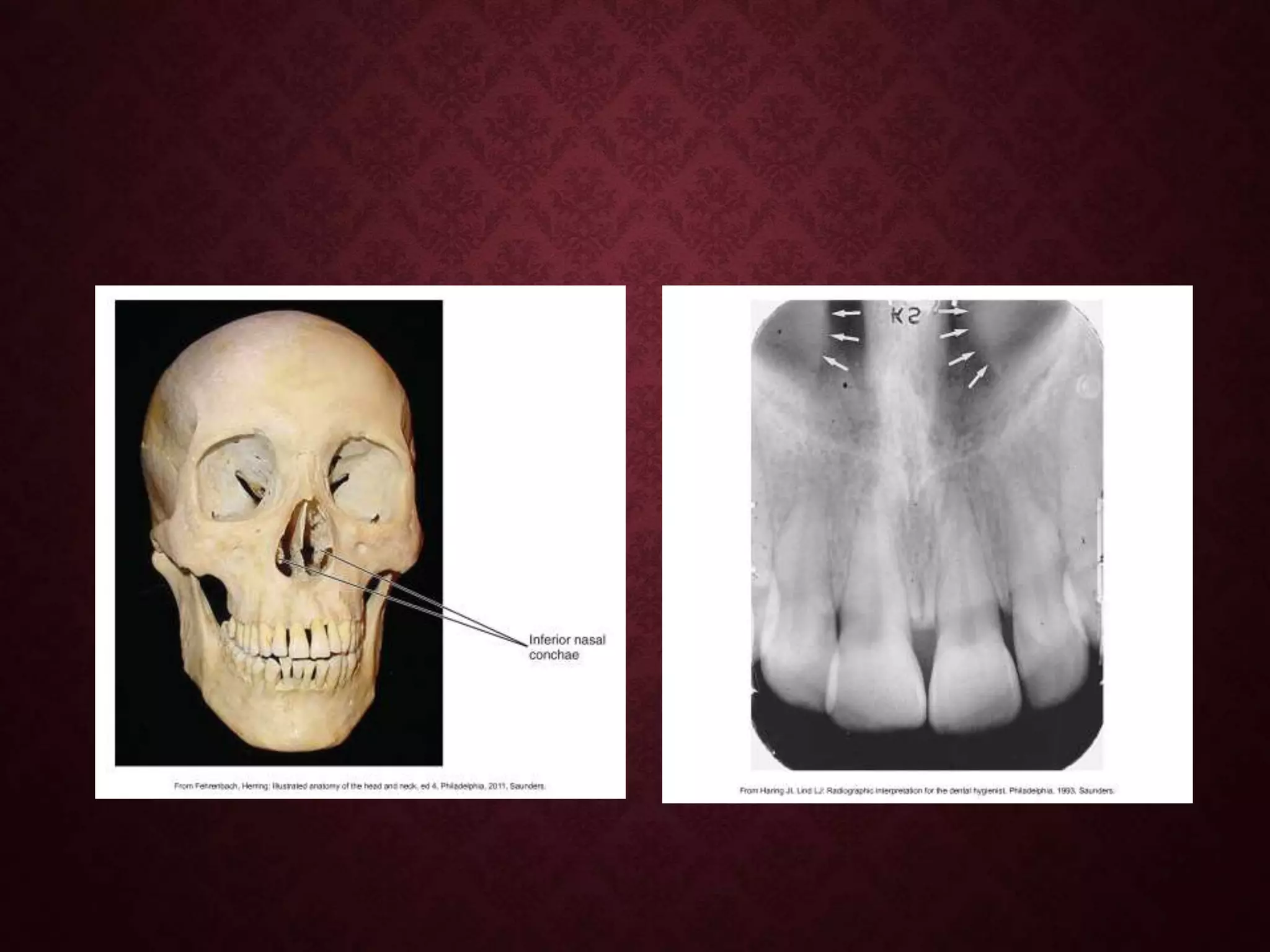 Chapter 27:Normal Anatomy: Intraoral Images | PPTX