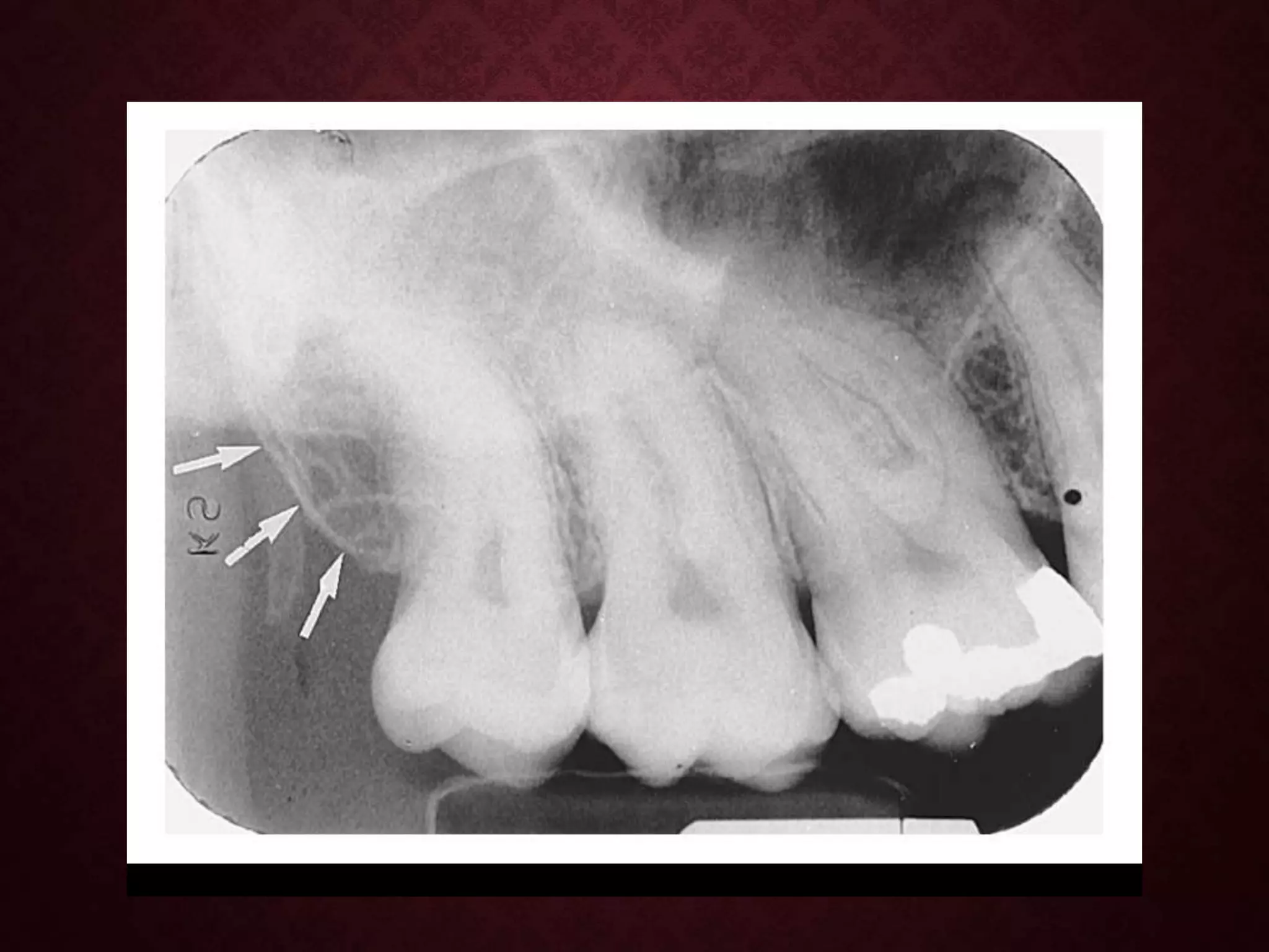 Chapter 27:Normal Anatomy: Intraoral Images | PPTX