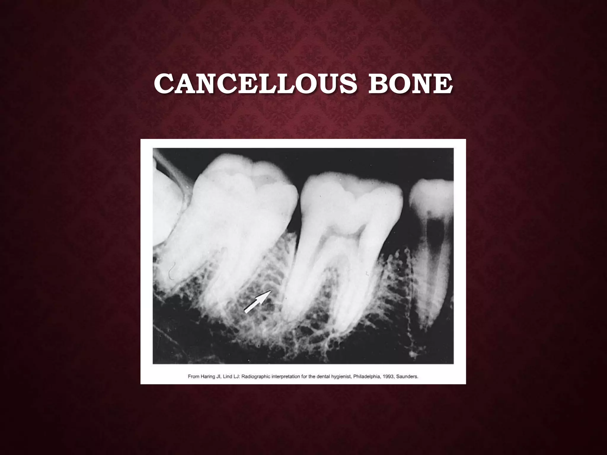 Chapter 27:Normal Anatomy: Intraoral Images | PPTX