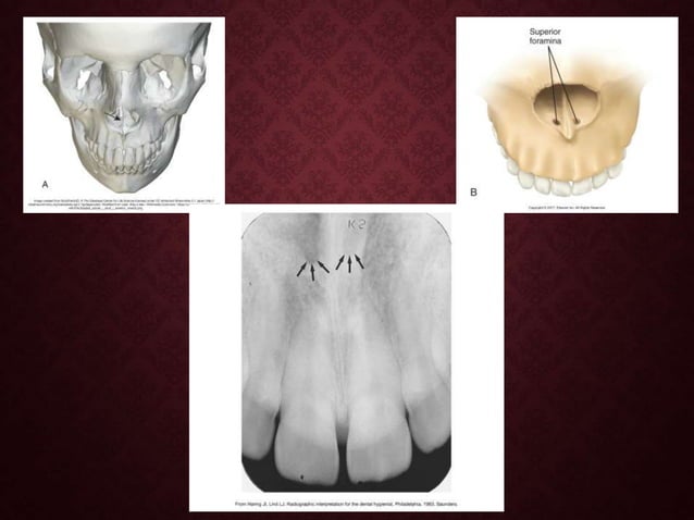 Chapter 27:Normal Anatomy: Intraoral Images | PPTX | Bone and Joint ...