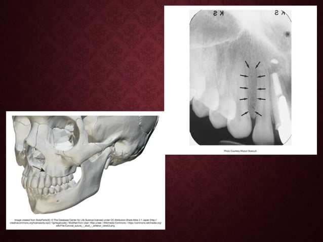 Chapter 27:Normal Anatomy: Intraoral Images | PPTX | Bone and Joint ...