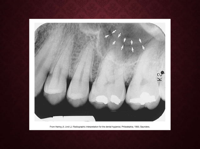 Chapter 27:Normal Anatomy: Intraoral Images | PPTX | Bone and Joint ...