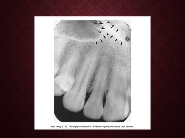 Chapter 27:Normal Anatomy: Intraoral Images | PPTX | Bone and Joint ...