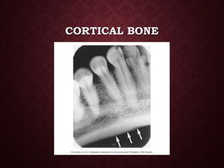 Chapter 27:Normal Anatomy: Intraoral Images | PPTX