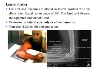 chapter 2a.pptx radiology by Dr. Bereket M | PPTX