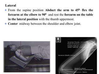 chapter 2a.pptx radiology by Dr. Bereket M | PPTX