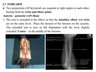 chapter 2a.pptx radiology by Dr. Bereket M | PPTX