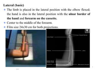 chapter 2a.pptx radiology by Dr. Bereket M | PPTX
