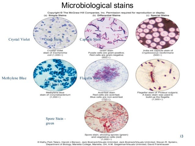 Differential Stains Microbiology Microbiology Lab Mic - vrogue.co