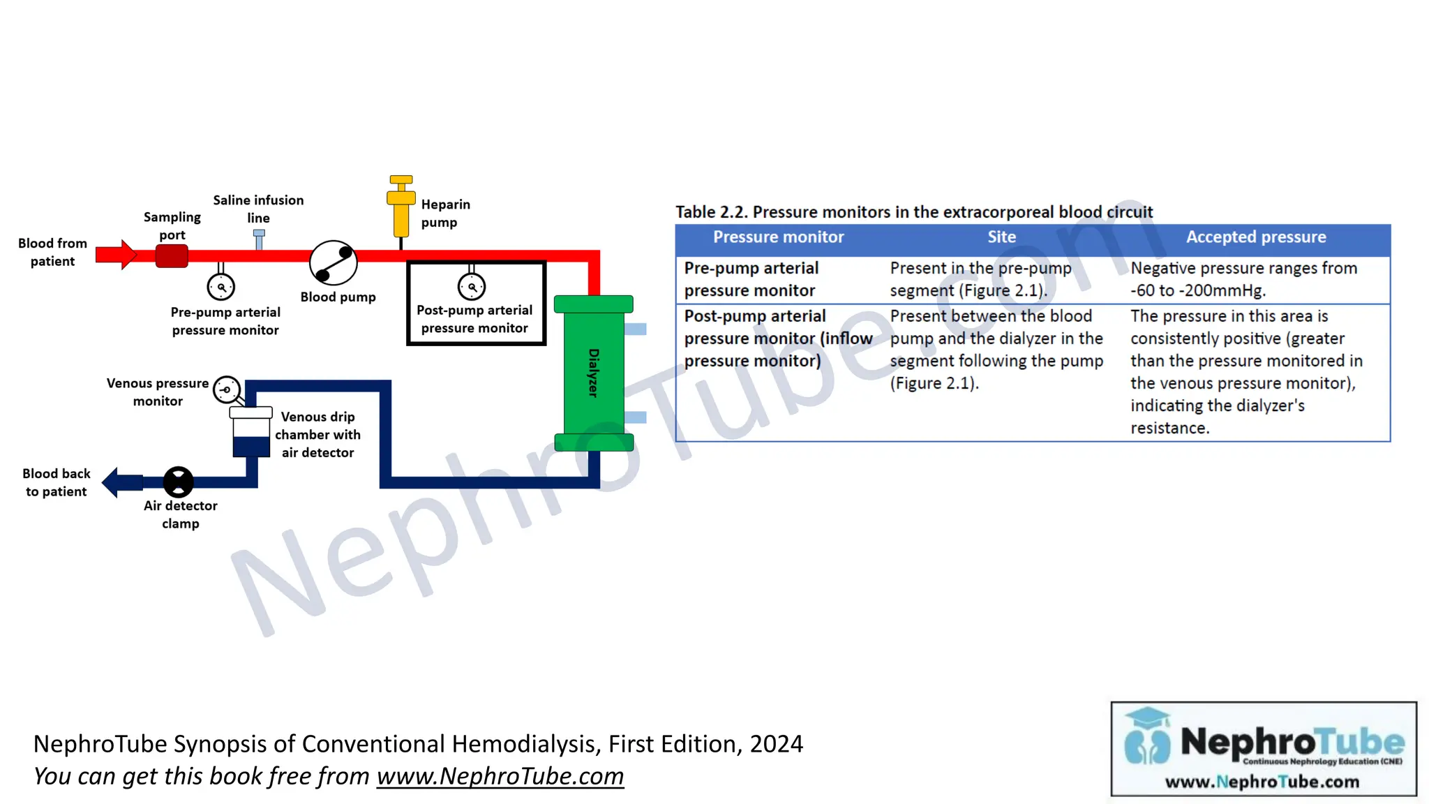 Hemodialysis: Chapter 2, Extracorporeal Blood Circuit - Dr.Gawad | PDF