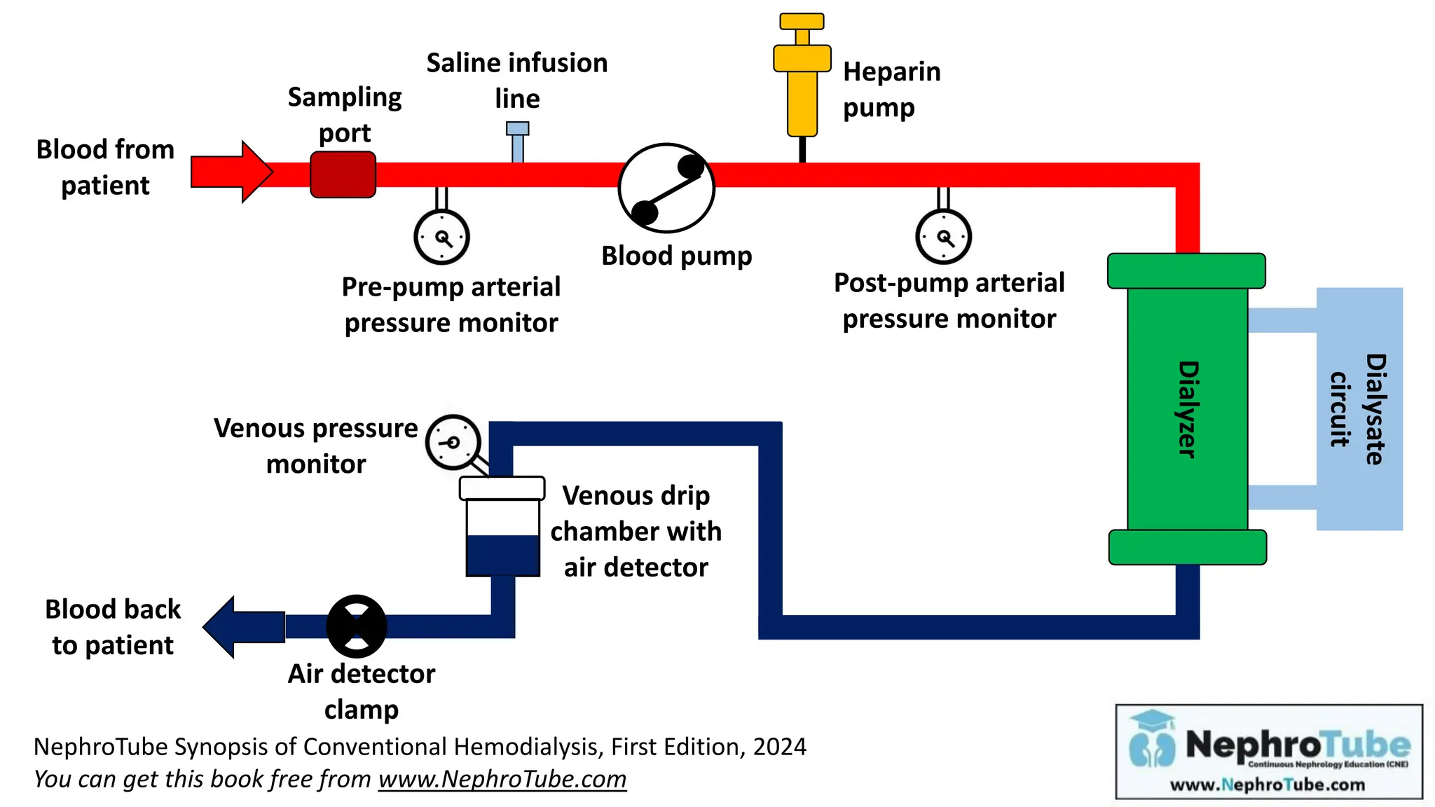 Hemodialysis: Chapter 2, Extracorporeal Blood Circuit - Dr.Gawad | PDF