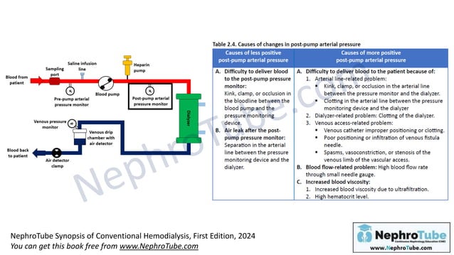 Hemodialysis: Chapter 2, Extracorporeal Blood Circuit - Dr.Gawad | PDF