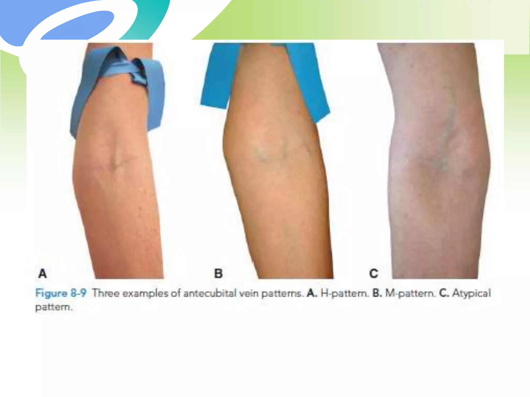 phlebotomy related vascular anatomy | PPTX