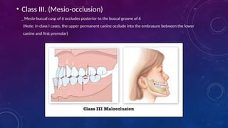 Chapter 3: Malocclusion and normal occlusion.pptx