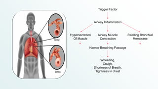 Pharmacotherapeutics-Asthma | PDF