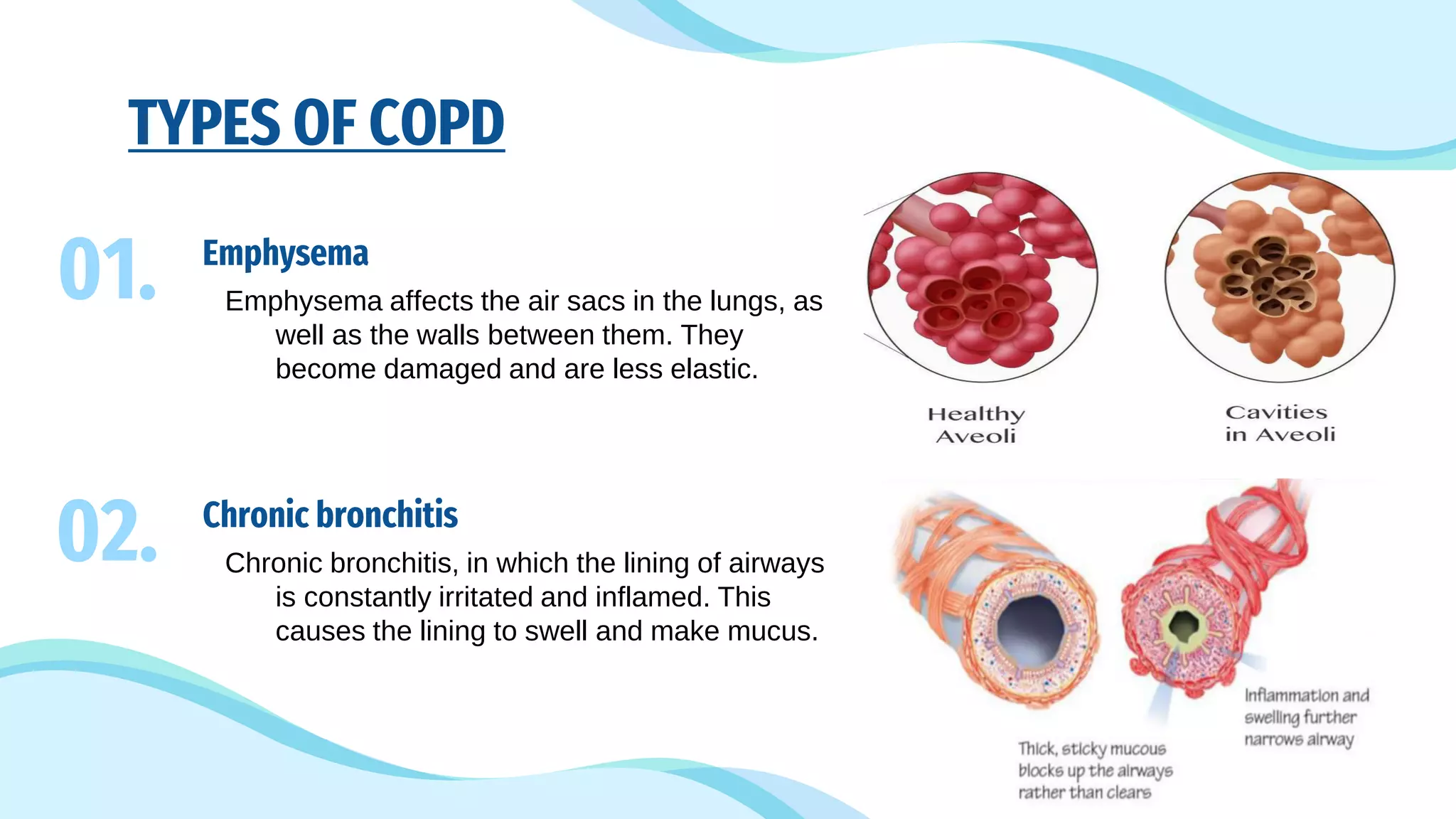 COPD-Chronic Obstructive Pulmonary Disease | PPT