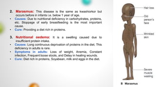 Proteins: Biochemistry | PPTX