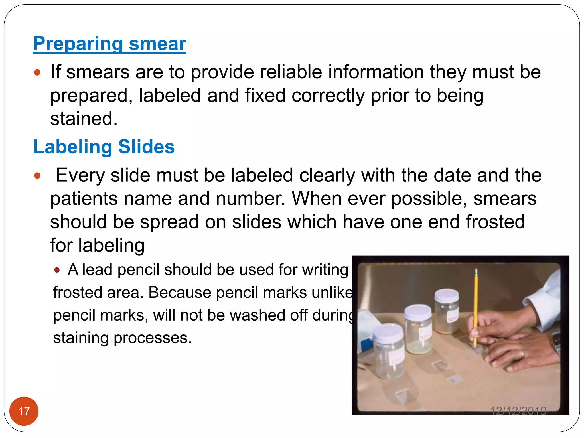 staining in medical laboratory | PPT