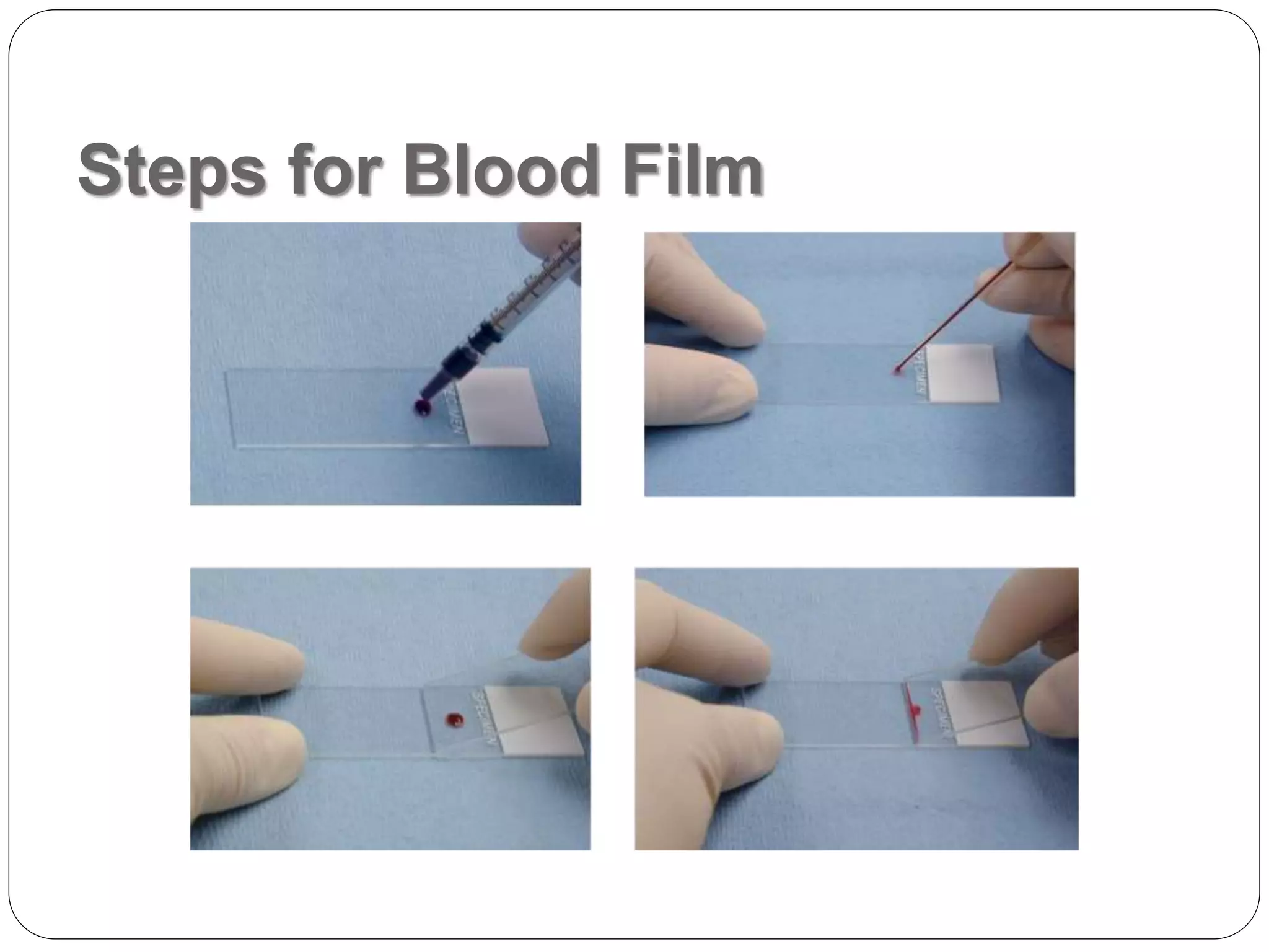 staining in medical laboratory | PPT