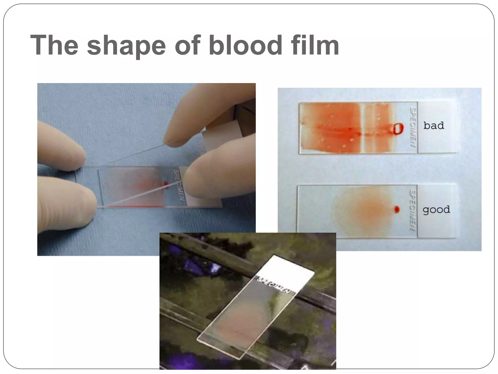 staining in medical laboratory | PPT