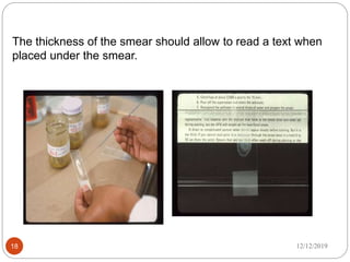 staining in medical laboratory | PPT
