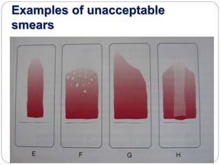 staining in medical laboratory | PPT