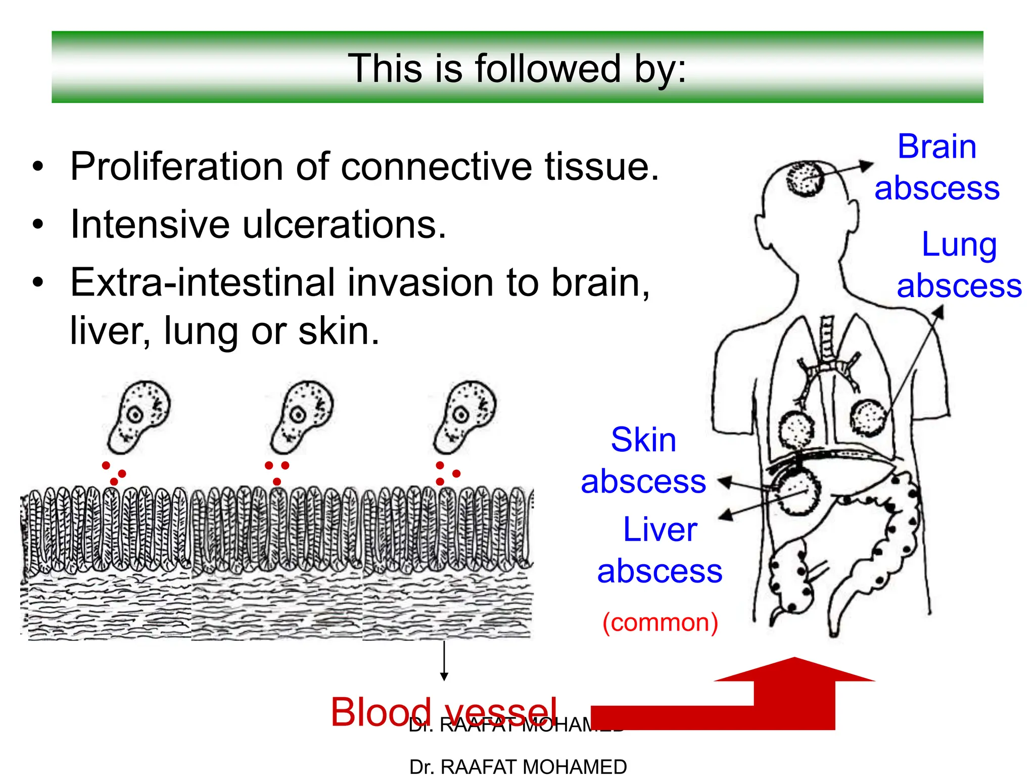 Chapter 3 - THE AMOEBAS.ppt