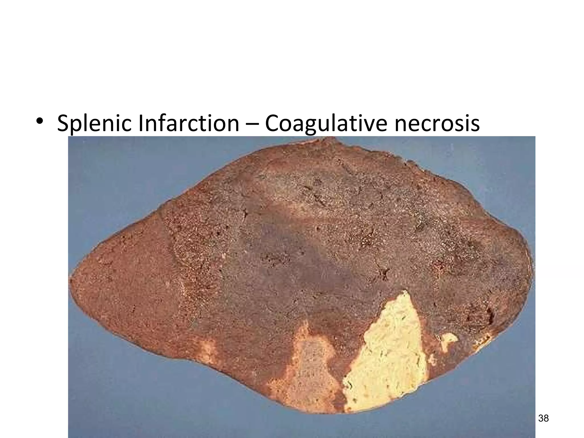 Tissue Response to Injury | PPT