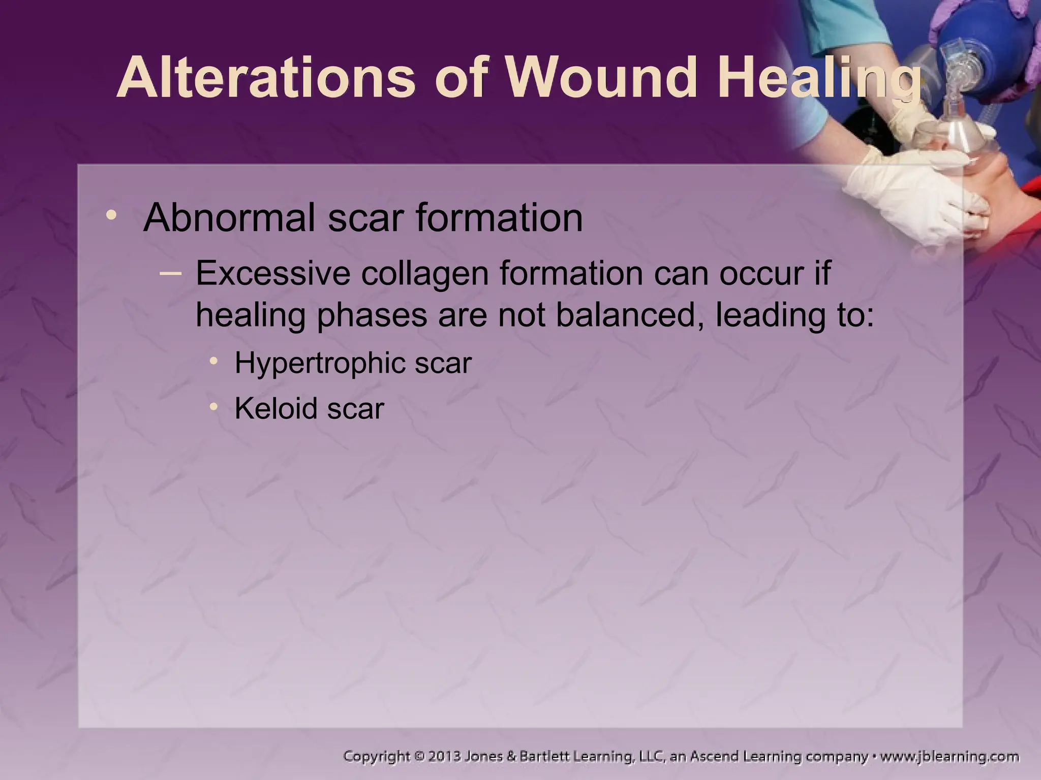 Soft Tissue Trauma for Pre-Hospital Provider | PPT